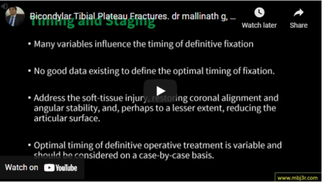 Bicondylar Tibial Plateau Fractures – MBJ Clinic – Bone & Joint ...